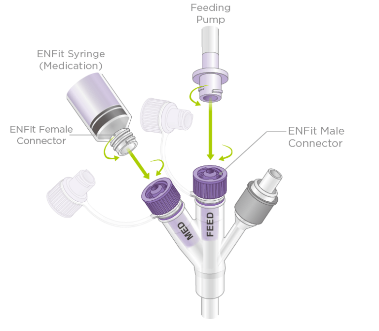 A Brief Introduction of 2023 New Product with ENFit Connector – Fortune ...