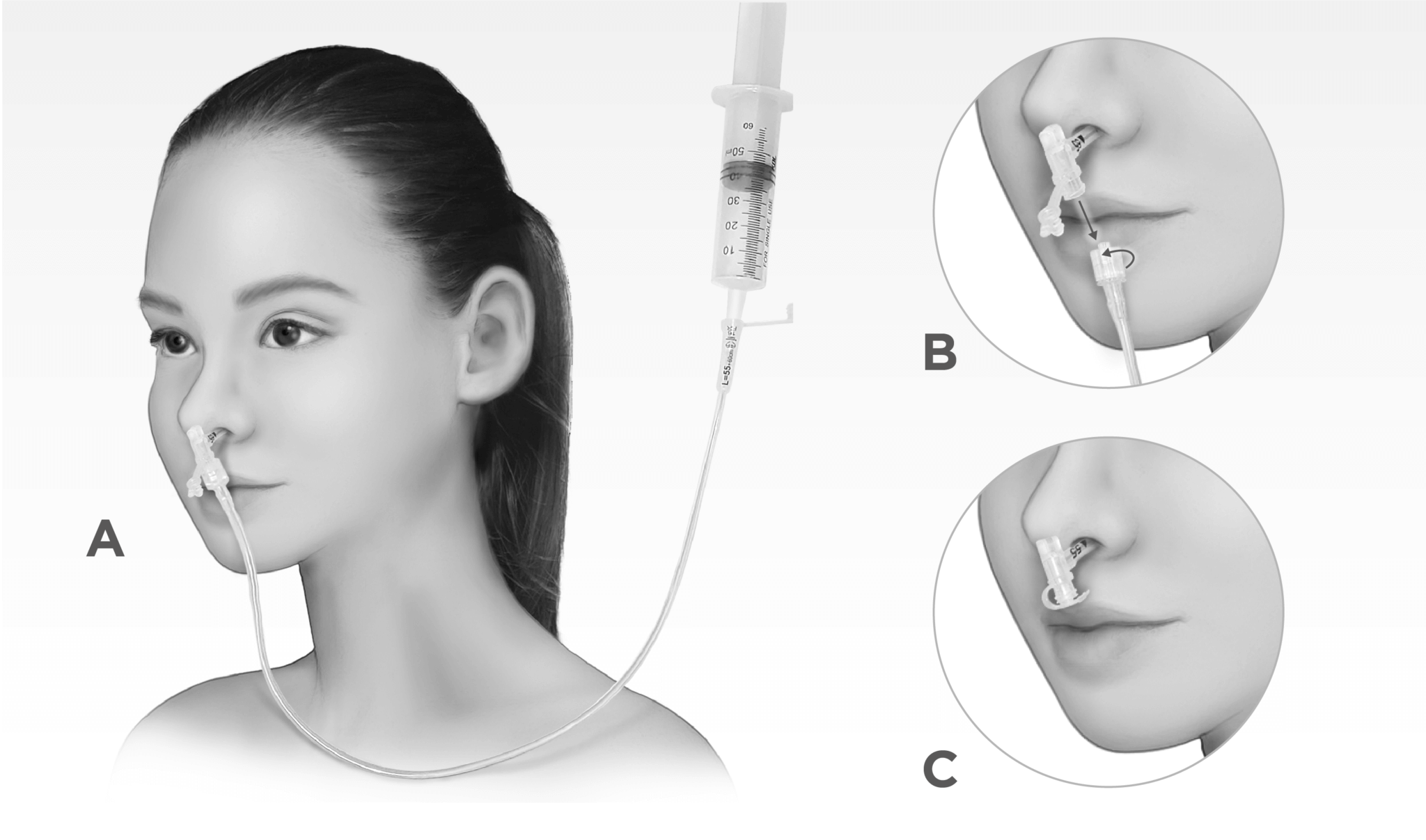 Silicone Gastric Tube, Detachable Type – Fortune Medical Instrument Corp.